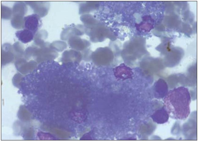 Atlas of Hematology